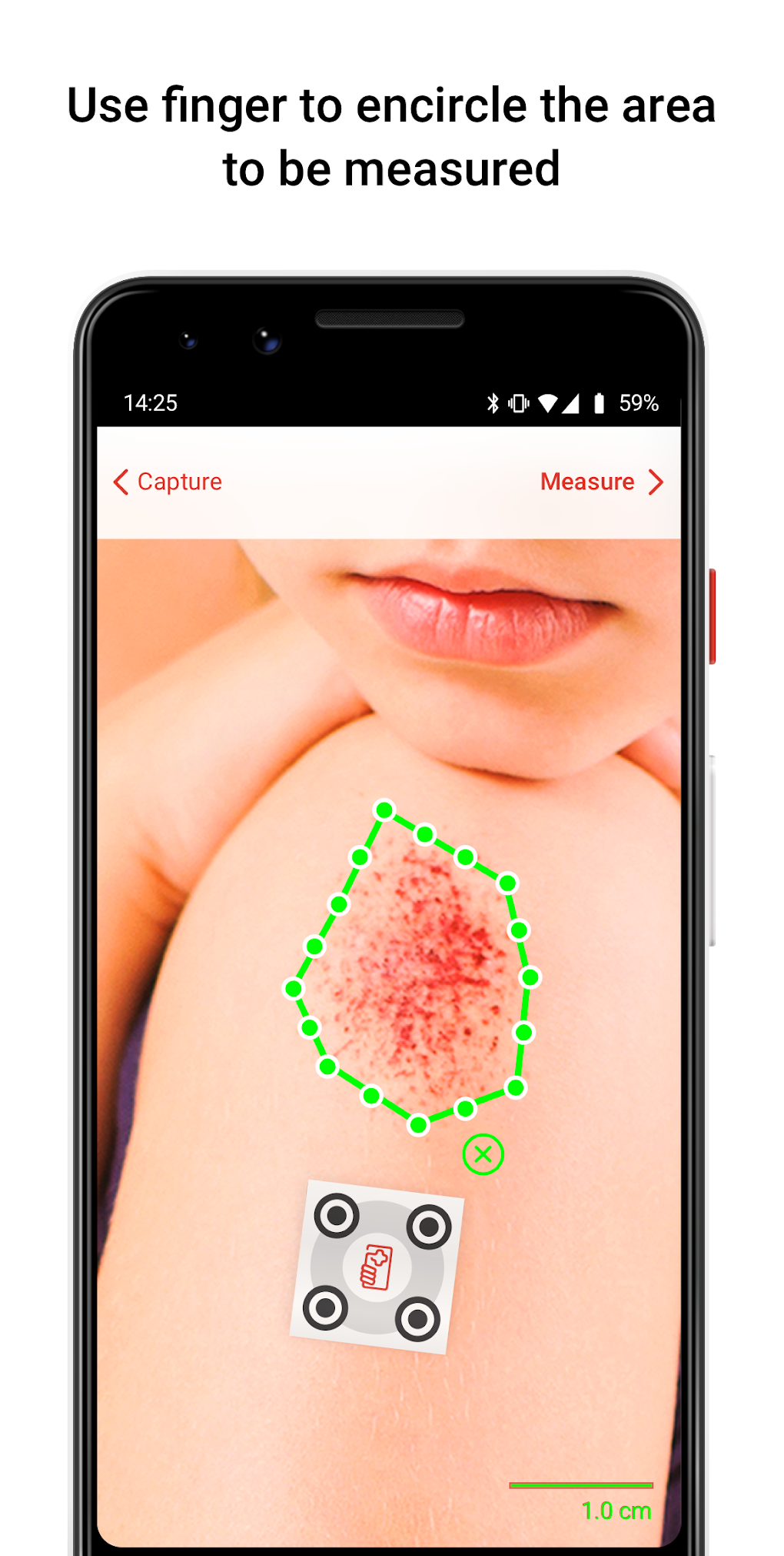 imitoMeasure - Measure Wounds APK pour Android - Télécharger