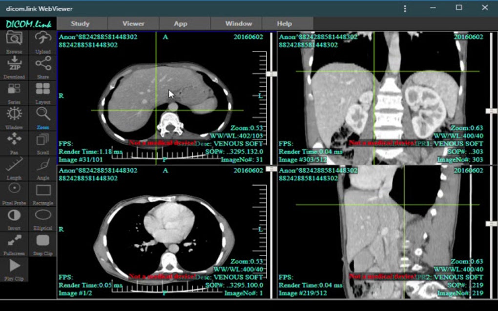 dicom.link Dicom Viewer para Google Chrome - Extensión Descargar