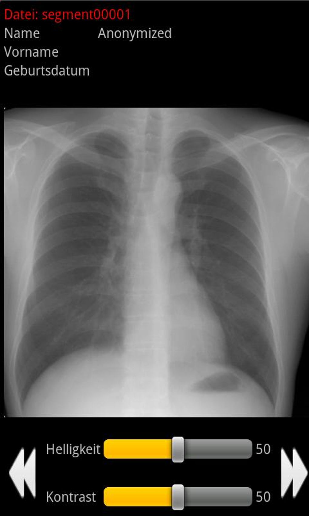 Minimal Dicom Viewer para Android - Descargar