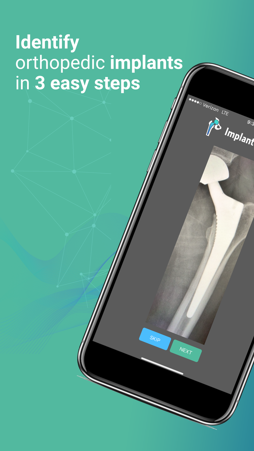 Implant Identifier para iPhone - Descargar