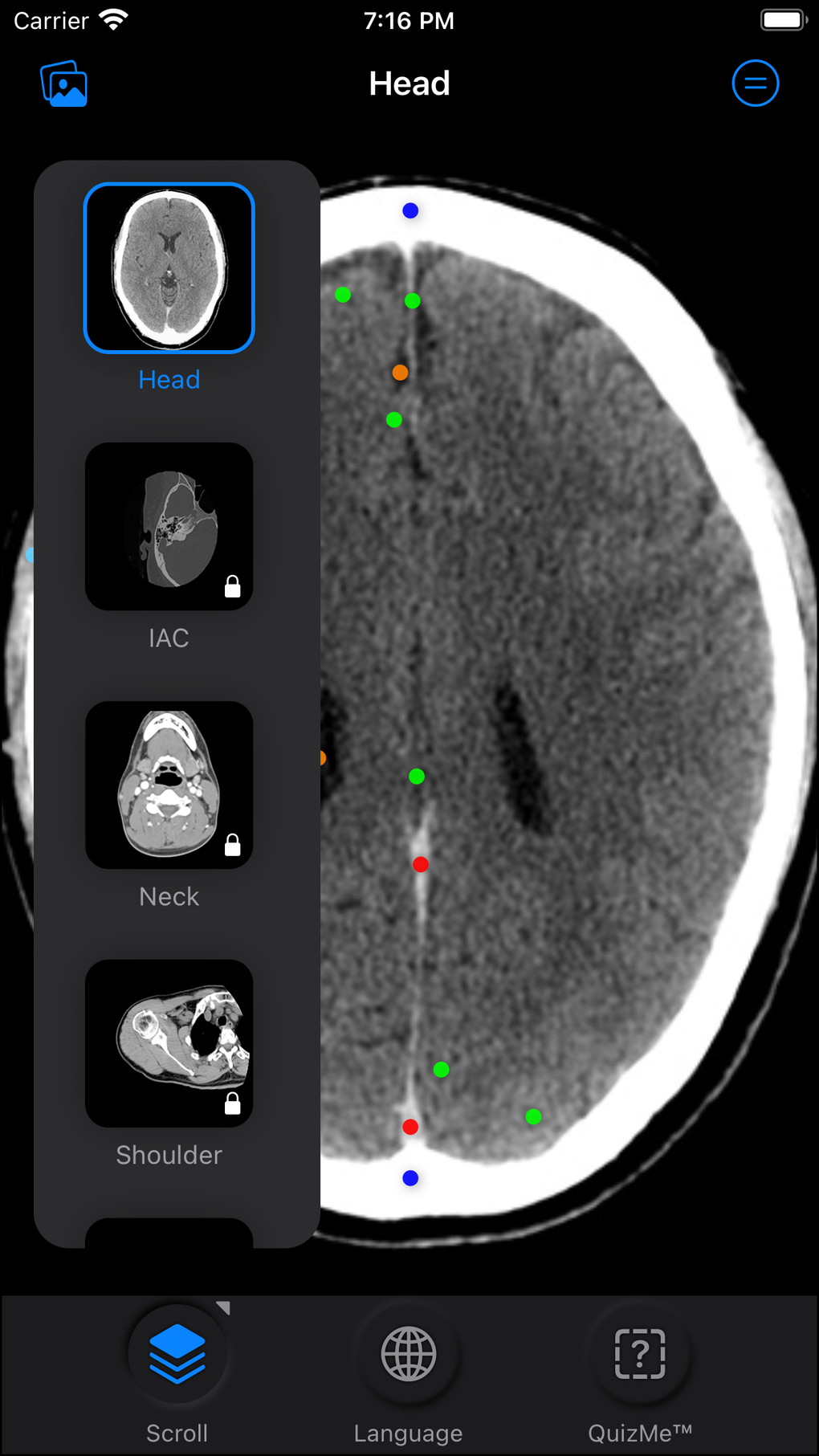 CT Anatomy para iPhone - Download