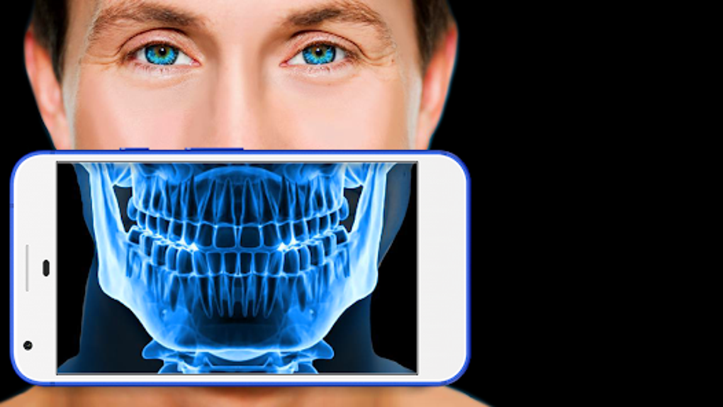 XRAY filter for images for Android - Download