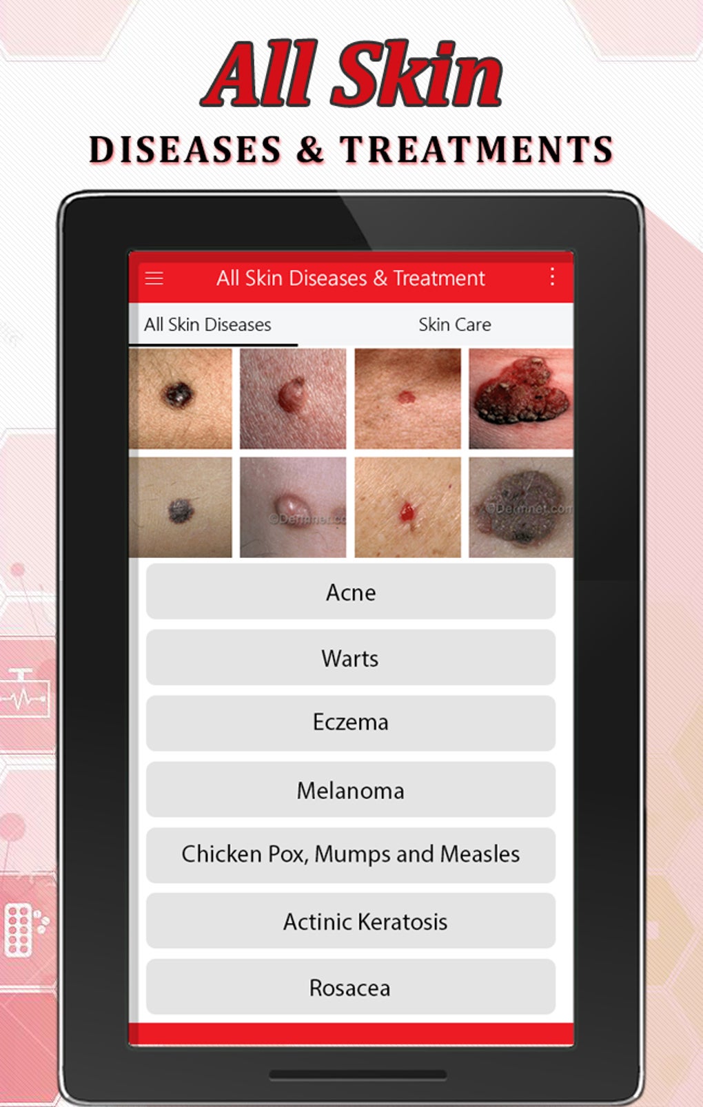 All Skin Diseases Treatment for Android - Download