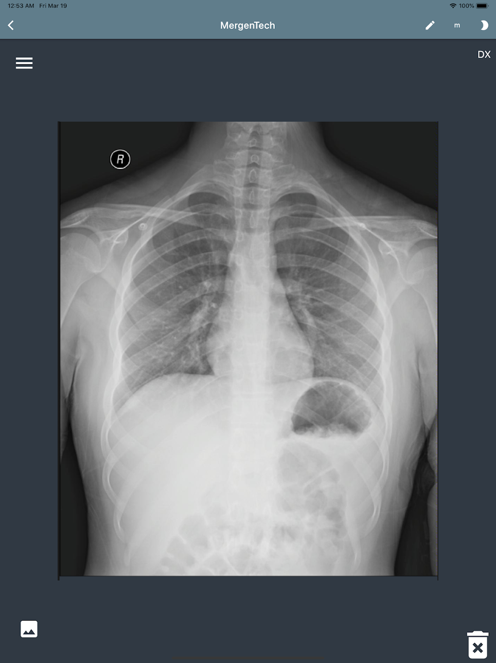 Mergen PACS for Android - Download