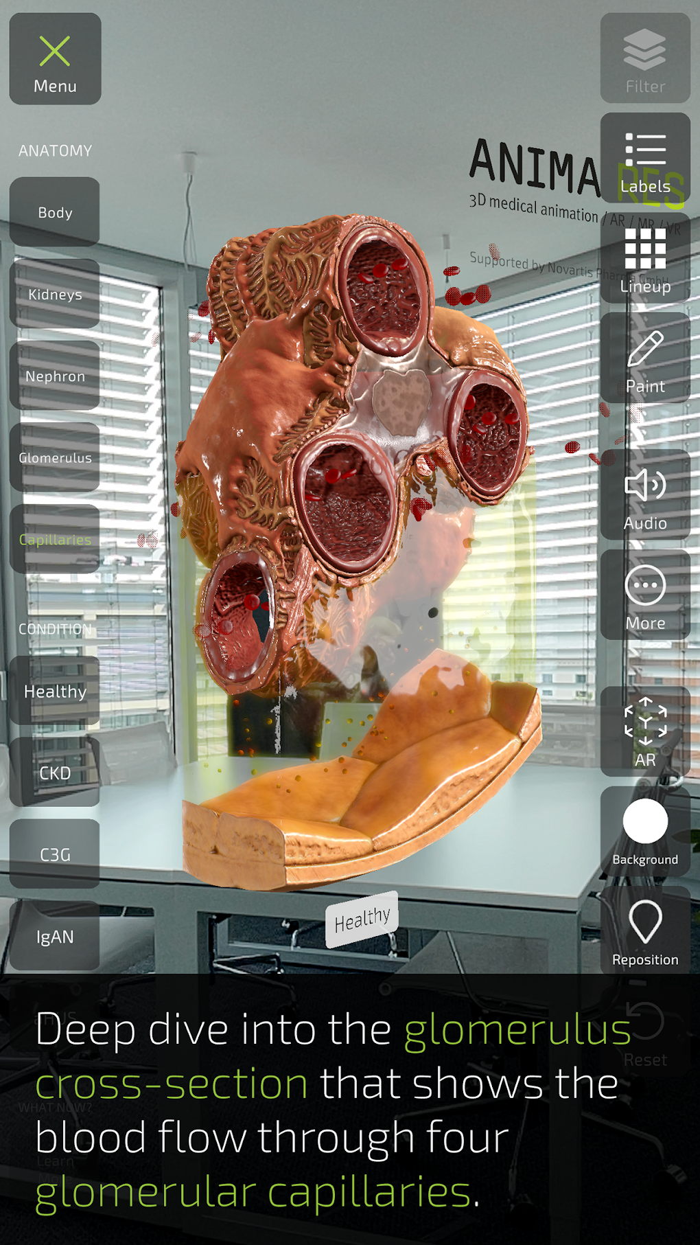INSIGHT KIDNEY for Android - Download