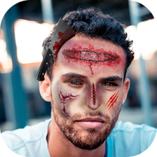Accident Prank Photo Editor - Fake Injury On Body for Android - Download
