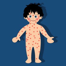 Rash para iPhone - Descargar