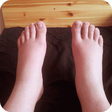 Android 용 Swelling Feet Home Remedies APK - 다운로드
