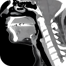 CT Neck APK for Android - Download
