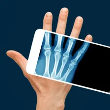 XRAY Scanner X-ray Doctor Game für Android - Download